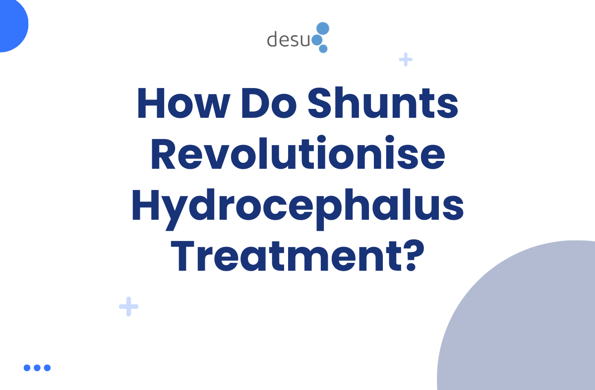 How Do Shunts Revolutionise Hydrocephalus Treatment?